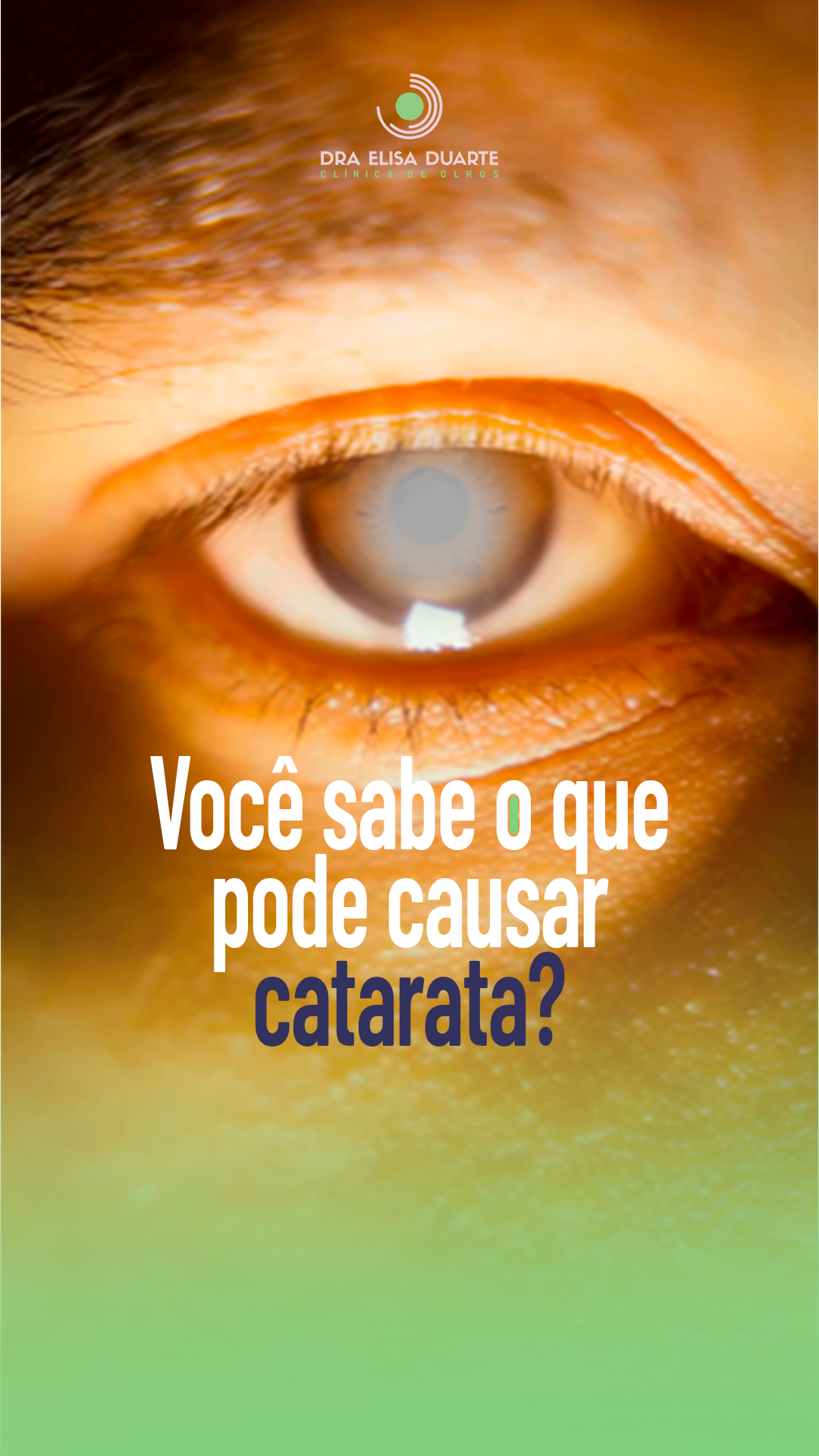 Quais motivos te levam a catarata - Dra. Elisa Duarte - Oftalmologista ...