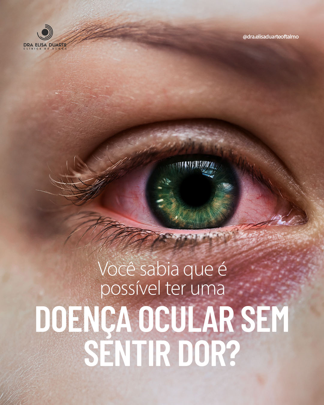 Você sabia que é possível ter uma doença ocular sem sentir dor? - Dra ...